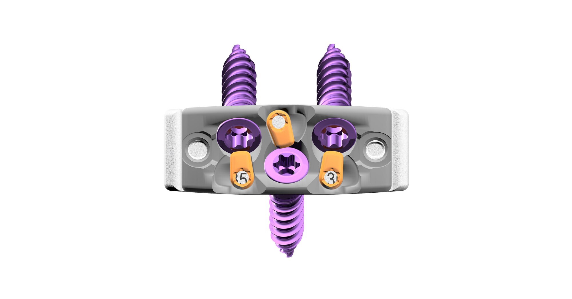 Zavation Medical Products, LLC announces launch of Varisync® ALIF System