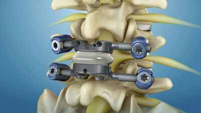 Premia Spine Wins Best Paper Award at SMISS 2024 for Study on Lumbar ...
