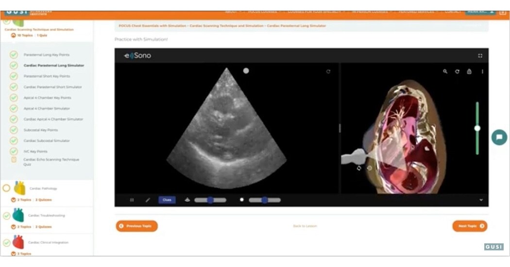 Global Ultrasound Institute (GUSI) Unveils POCUS Essentials Plus Simulation: A Game-Changing ...