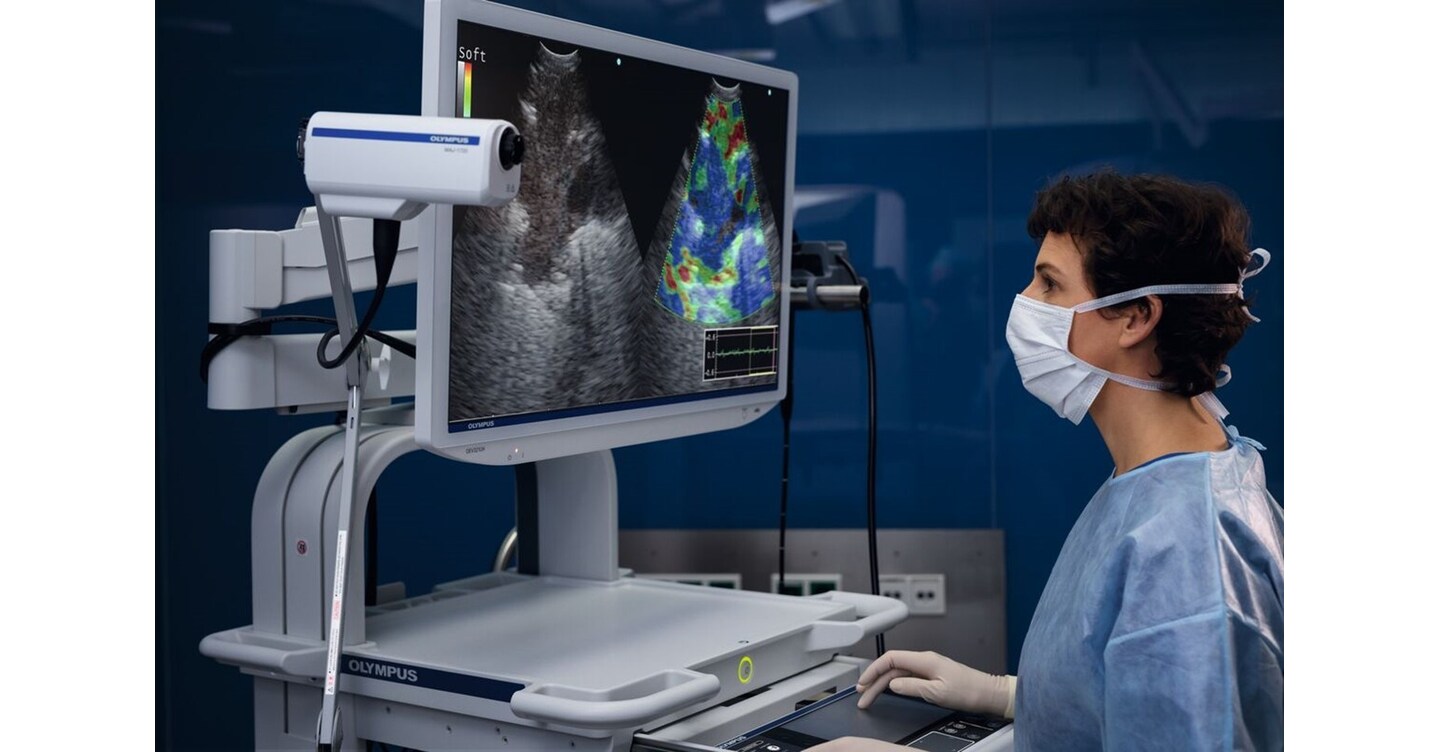 A Olympus Latin America anuncia lançamento do processador de ultrassom ...