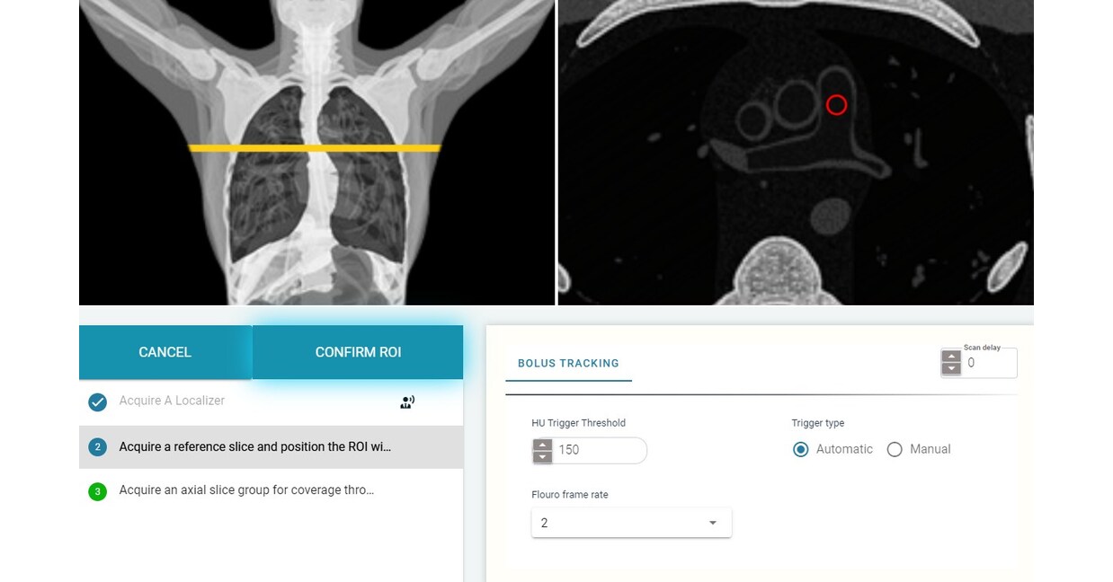 ScanLabCT Launches Virtual Patients Within Its CT Simulator Software