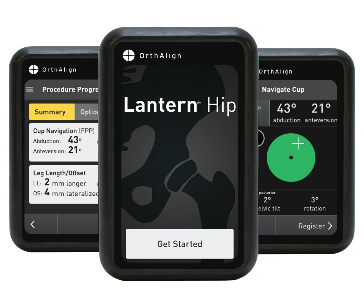 OrthAlign Receives FDA 510(k) Clearance for Lantern® Hip - Los Angeles ...