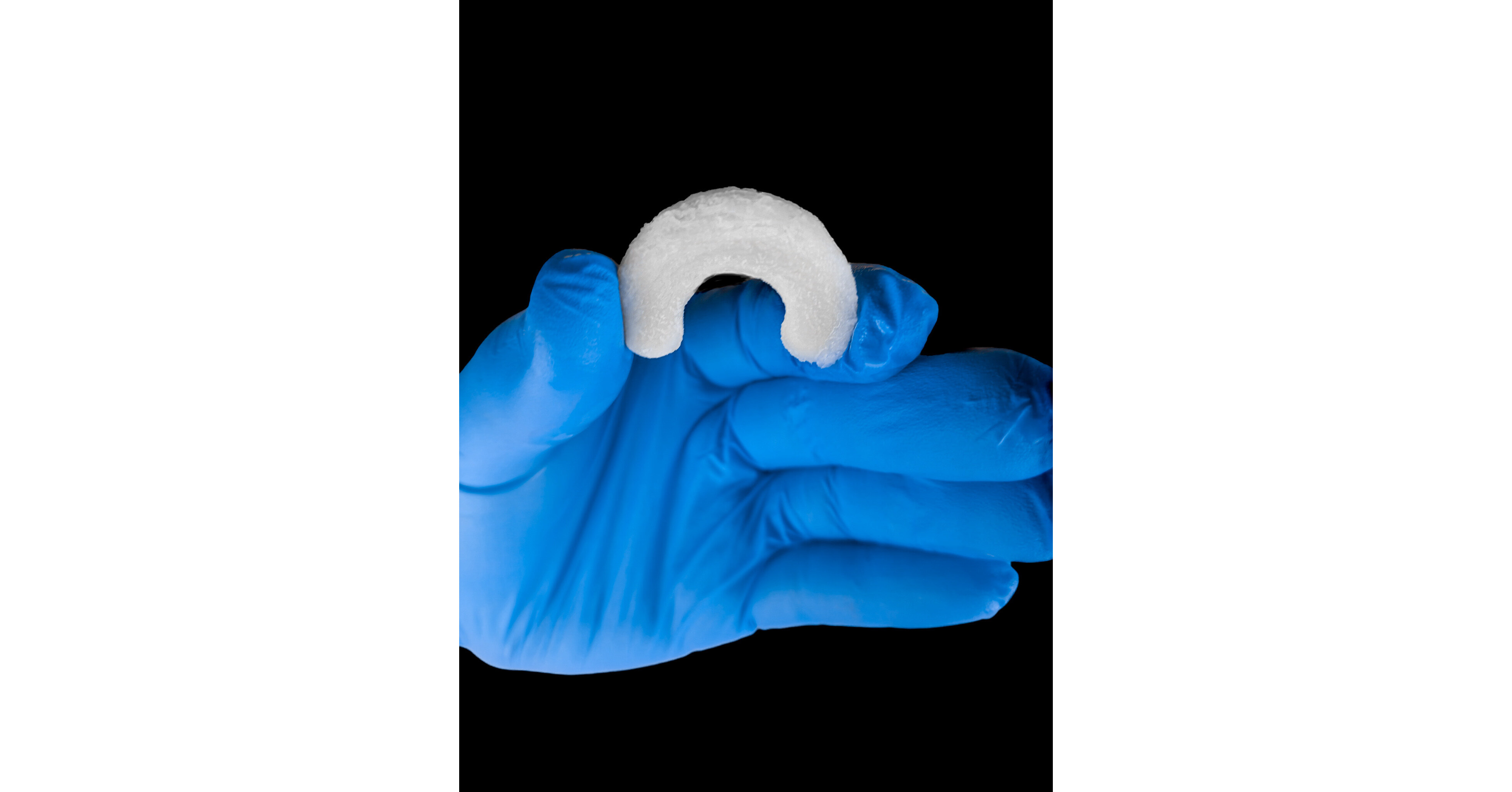 Regenity Biosciences Receives 510(k) Clearance for RejuvaKnee™, a ...