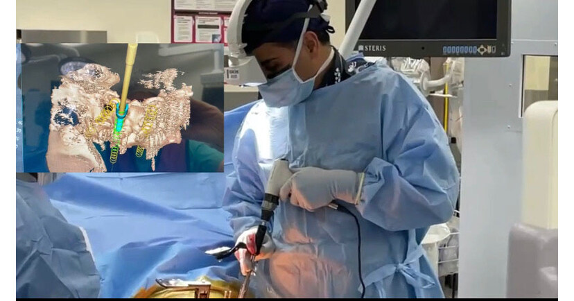 VSI Spine Surgeons Reach Milestone: 100th Augmented Reality-Assisted Spinal Fusion Surgery
