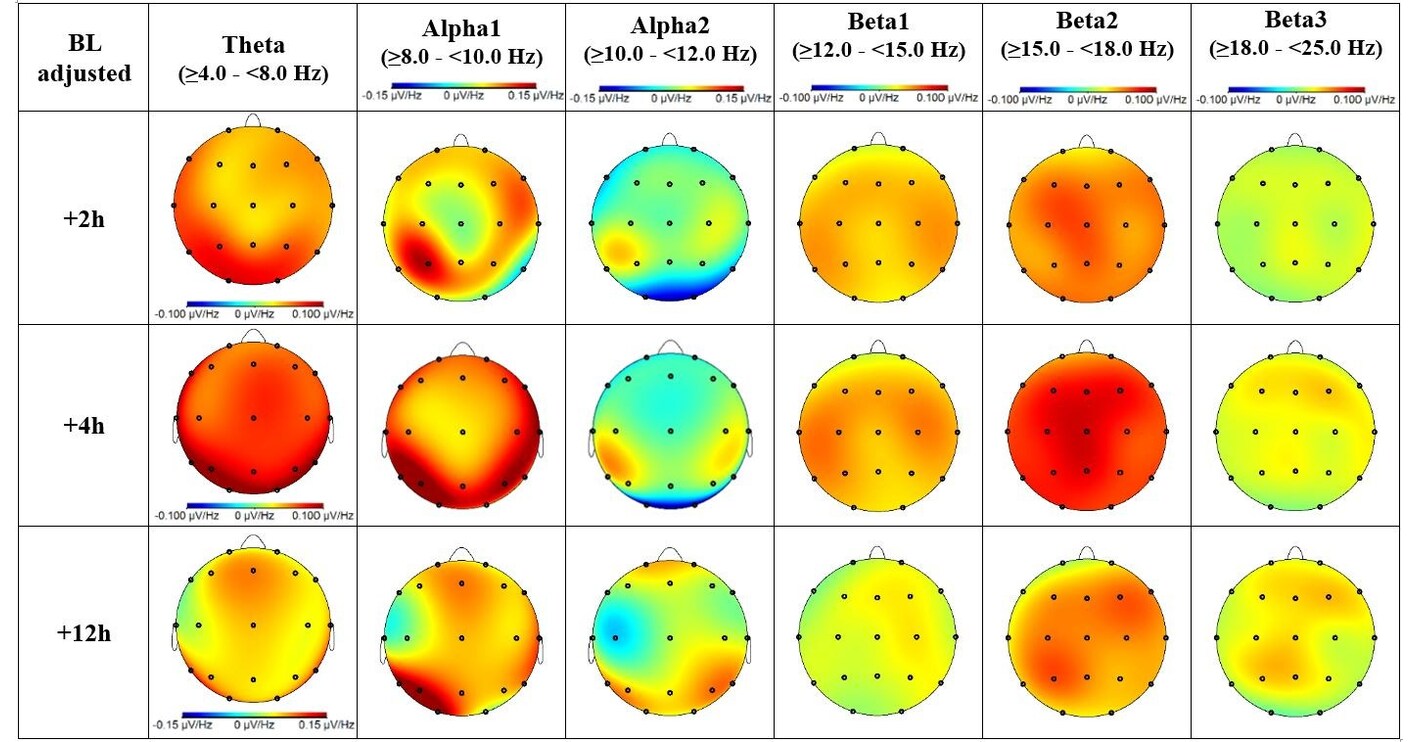 Lipocine Announces Positive Oral Brexanolone Quantitative EEG Results