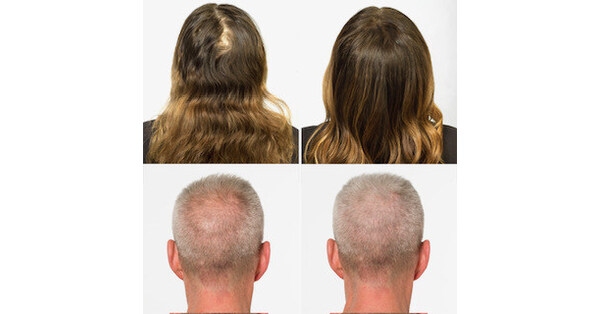 Clinically Proven Hair Restoration and Scalp Rejuvenation line, Hairapy ...