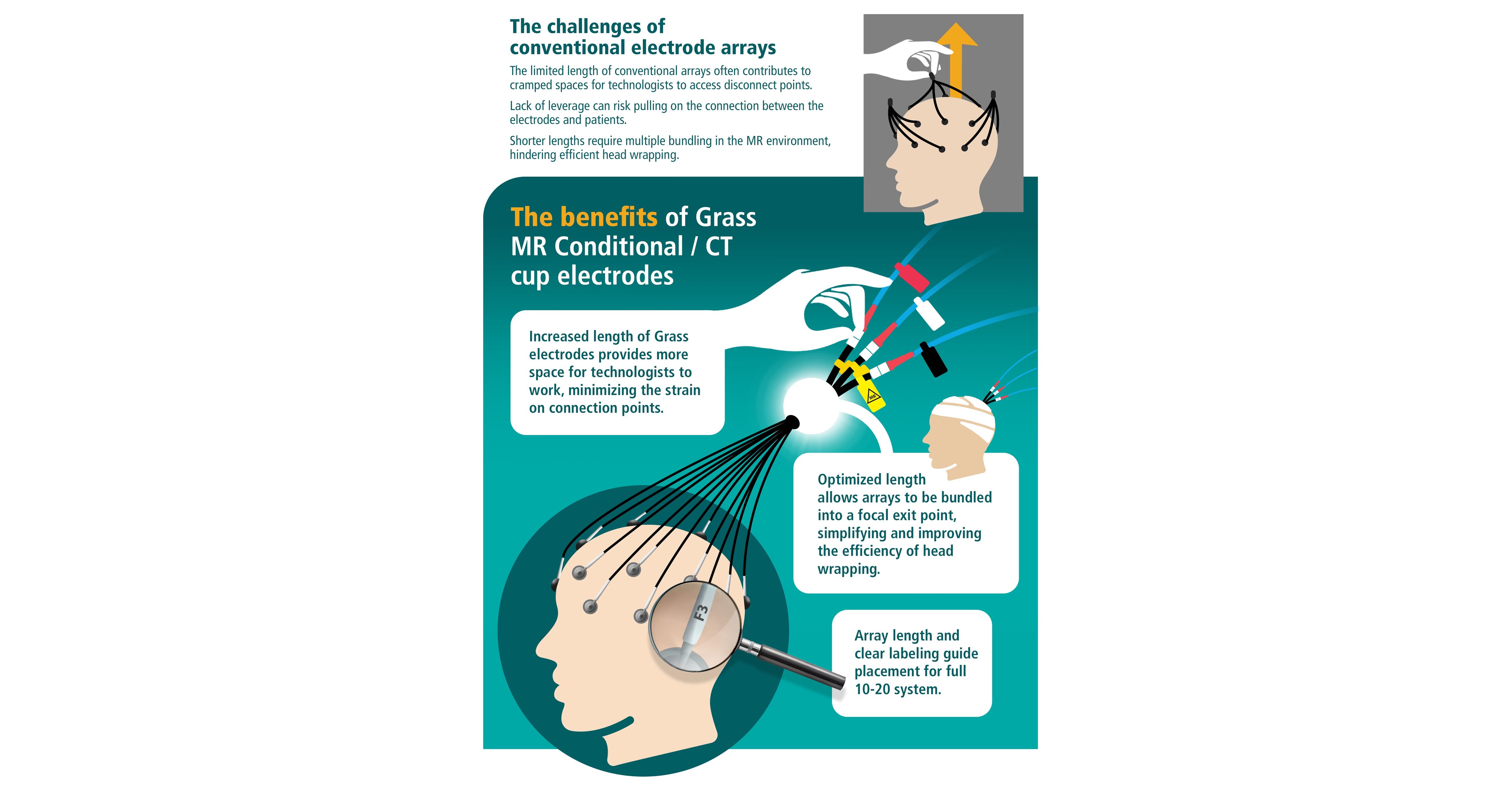 Natus introduces new FDA cleared Grass® MR Conditional / CT Cup ...