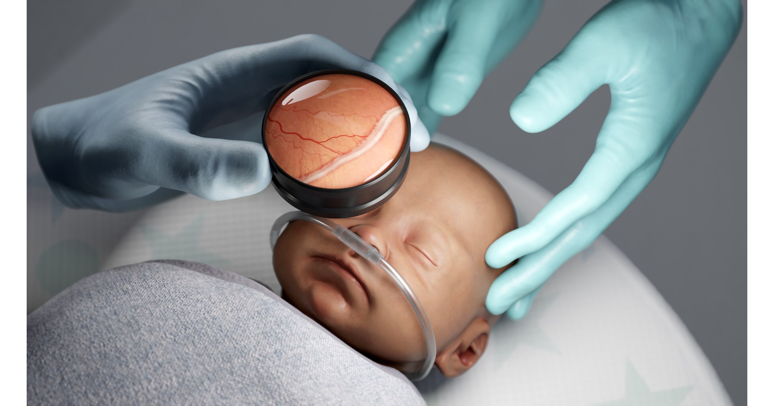 American Academy of Ophthalmology Launches VR Education Program in ...