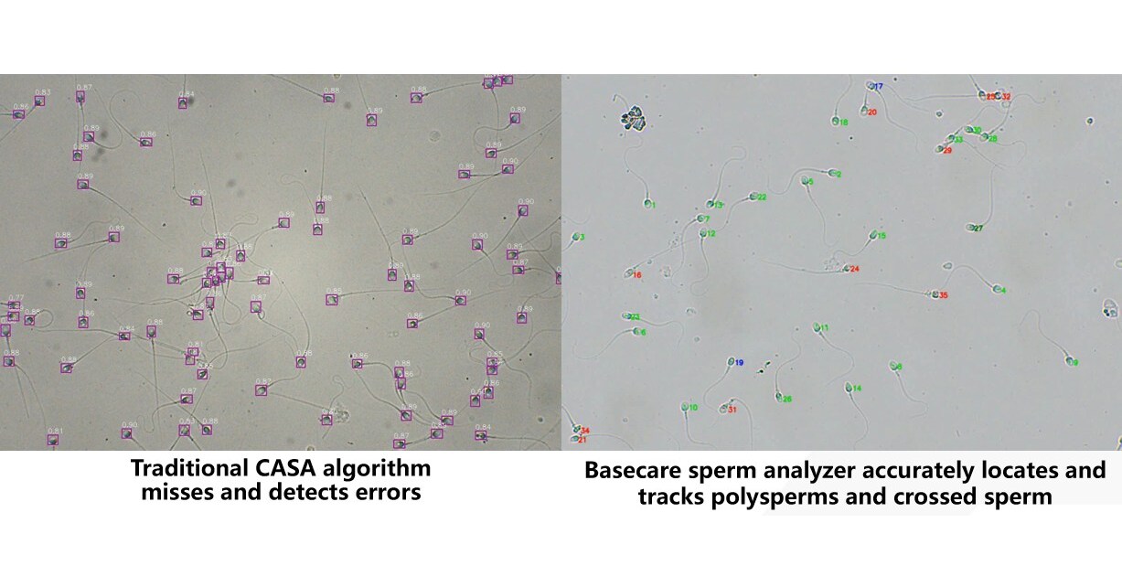 The world's first live sperm analyzer has been launched! The Basecare ...