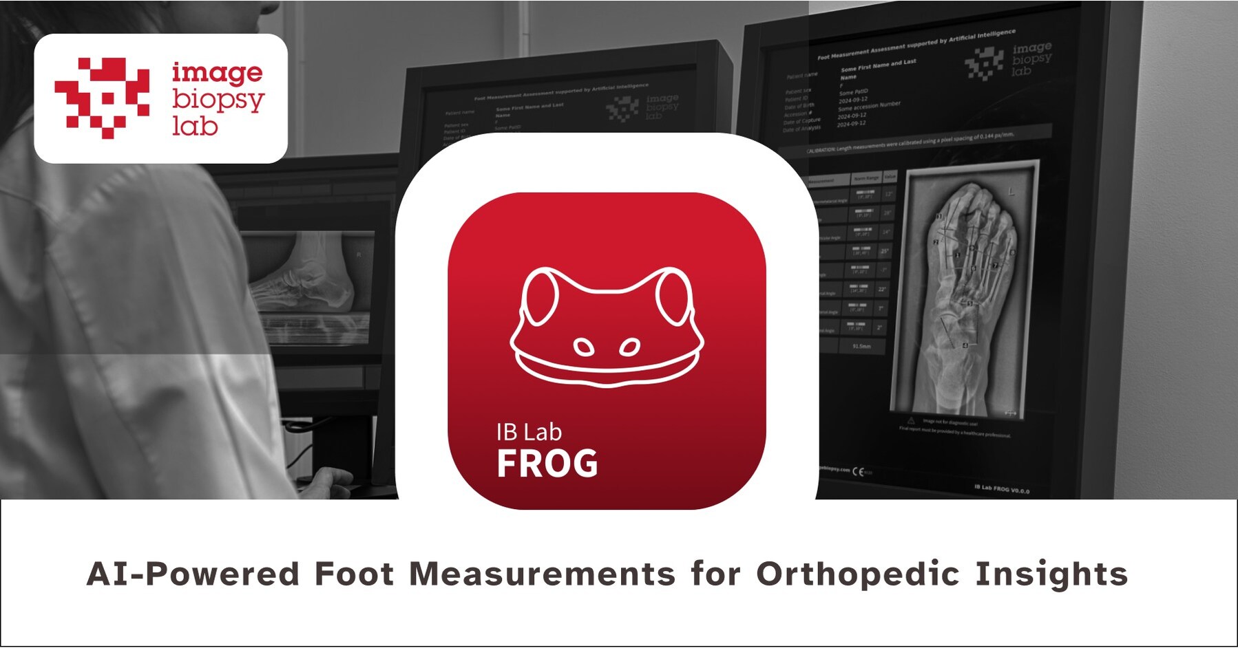 ImageBiopsy Lab launches IB Lab FROG: AI-powered Foot Measurements for ...