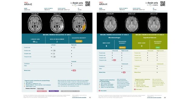 FDA authorizes the first AI-driven MRI solution for safer Alzheimer's ...