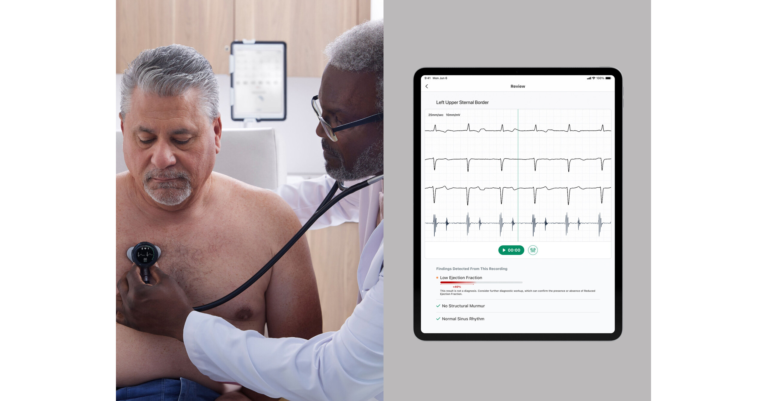 Eko Health Granted Category III CPT Code for SENSORA™ AI Heart Disease ...