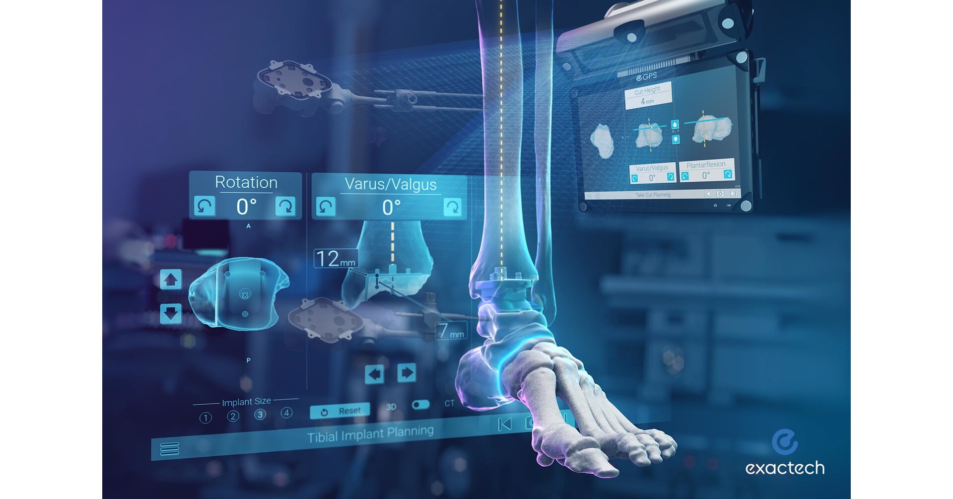 Exactech Announces First Surgeries with the World's First Surgical ...