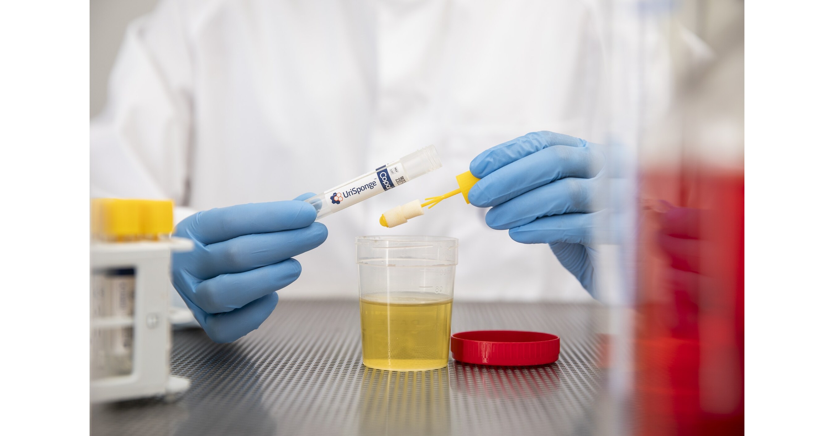 Copan Diagnostics Announces FDA Clearance for Innovative Urine ...