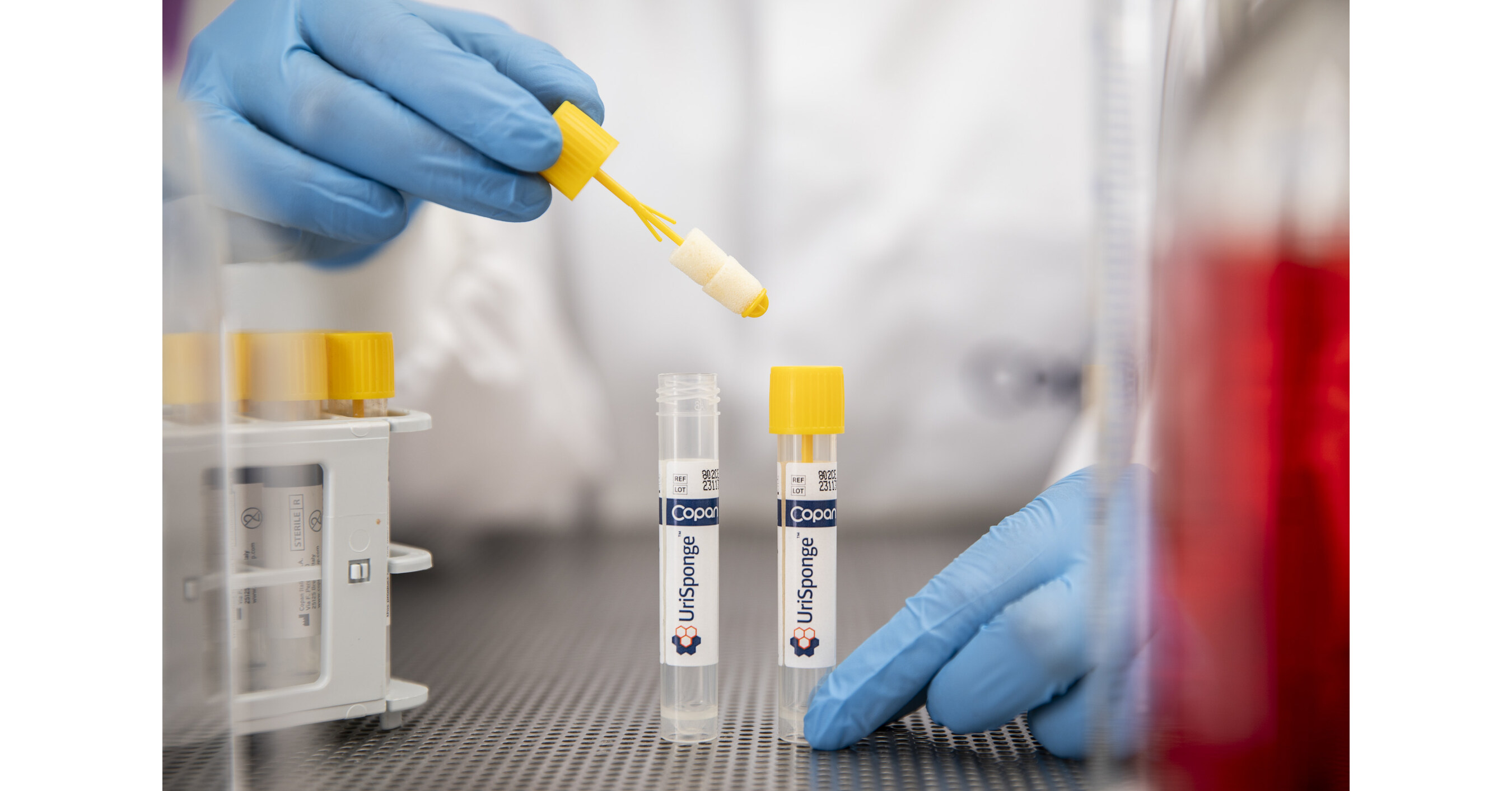 Copan Diagnostics Announces FDA Clearance for Innovative Urine ...