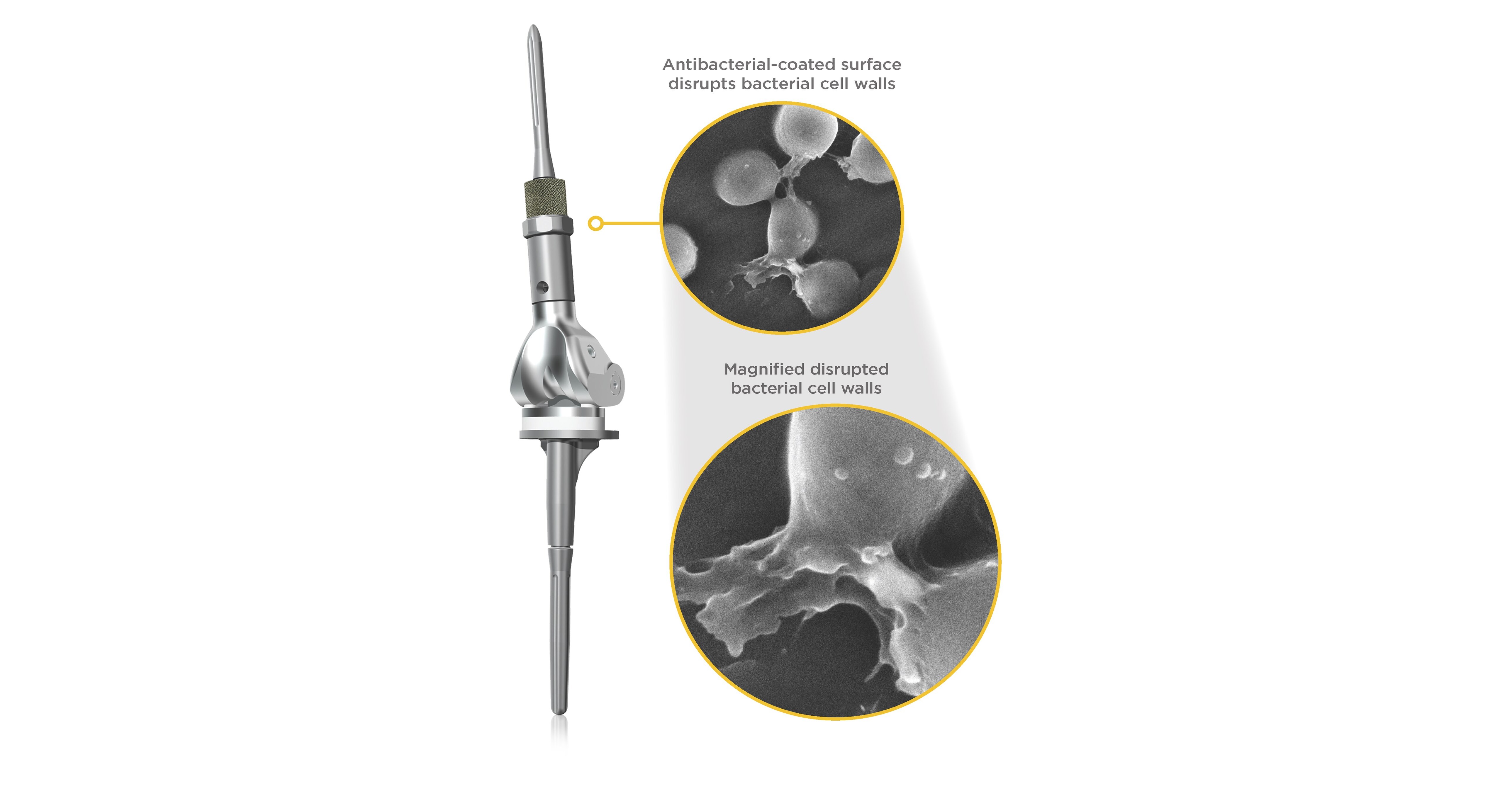 Onkos Surgical® Successfully Completes Groundbreaking, First-in-Human ...