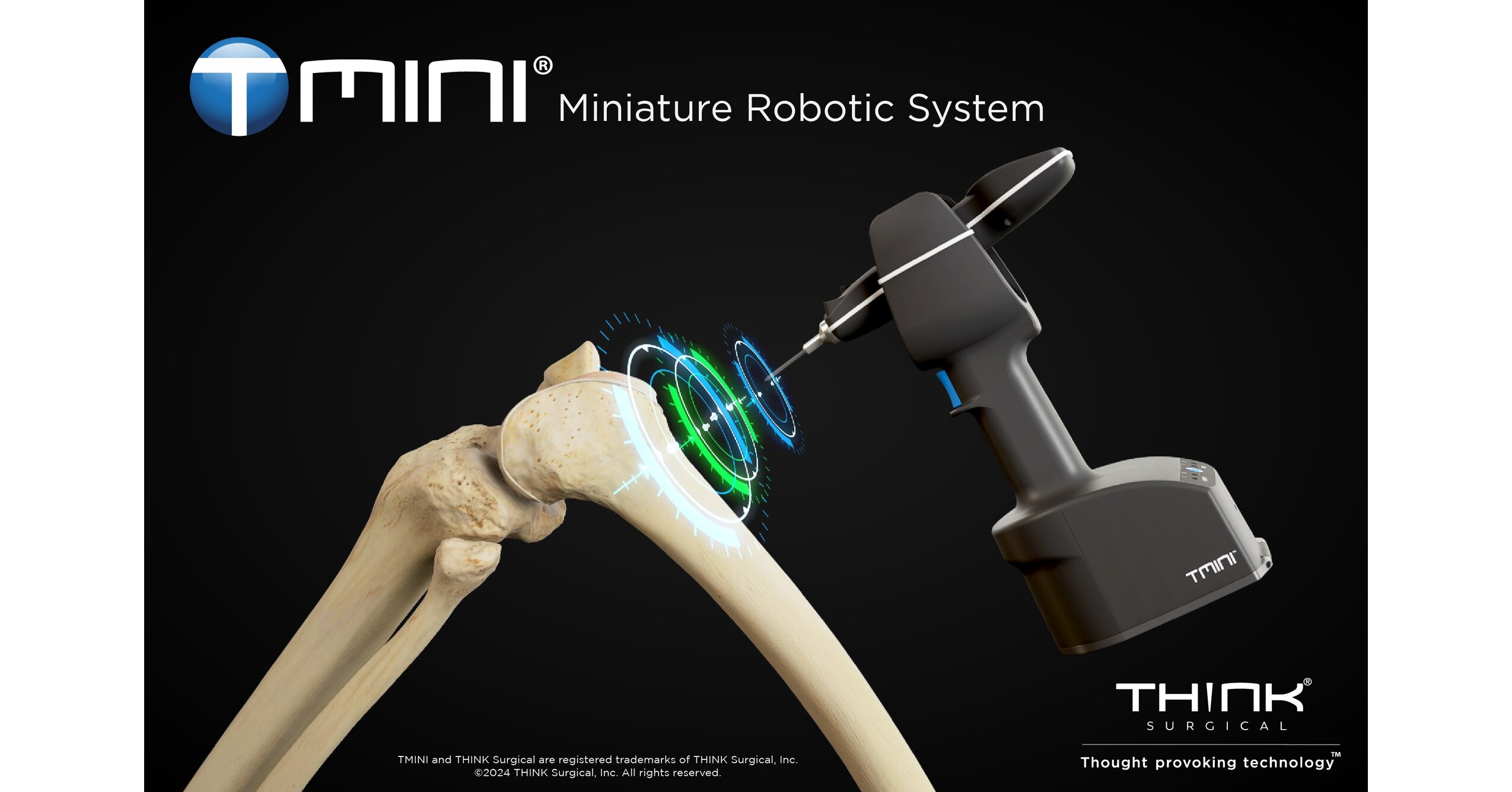 THINK Surgical Announces Its TMINI Miniature Robotic System Procedure ...