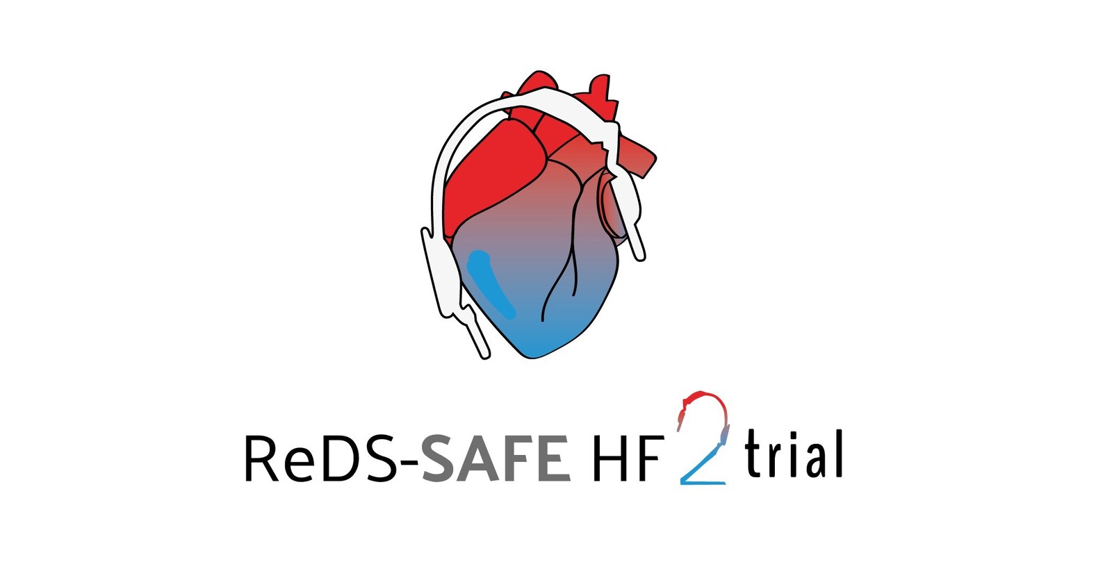 Initiation of ReDS-SAFE HF II Trial for Advancing Heart Failure Management