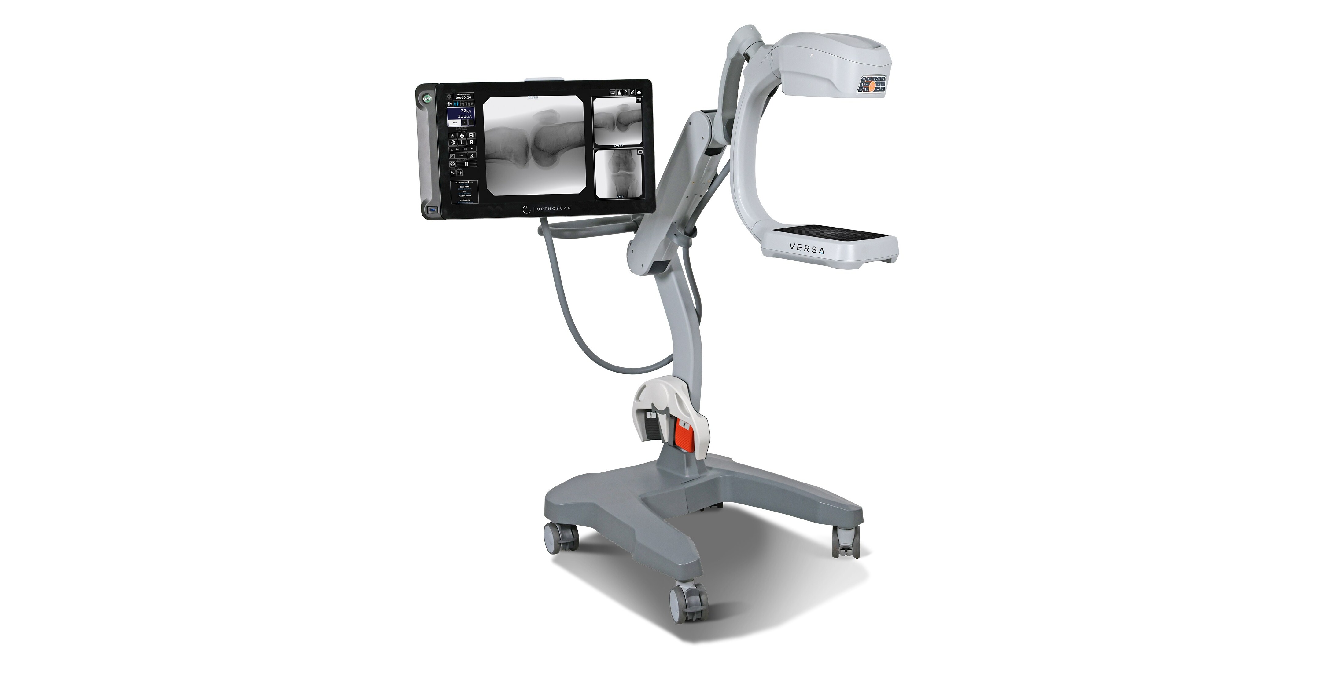 Orthoscan Unveils VERSA: A New Era in Mini C-Arm Imaging
