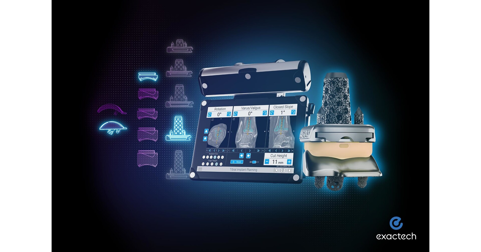 Exactech Debuts New Implant Technology with First-to-Market GPS ...