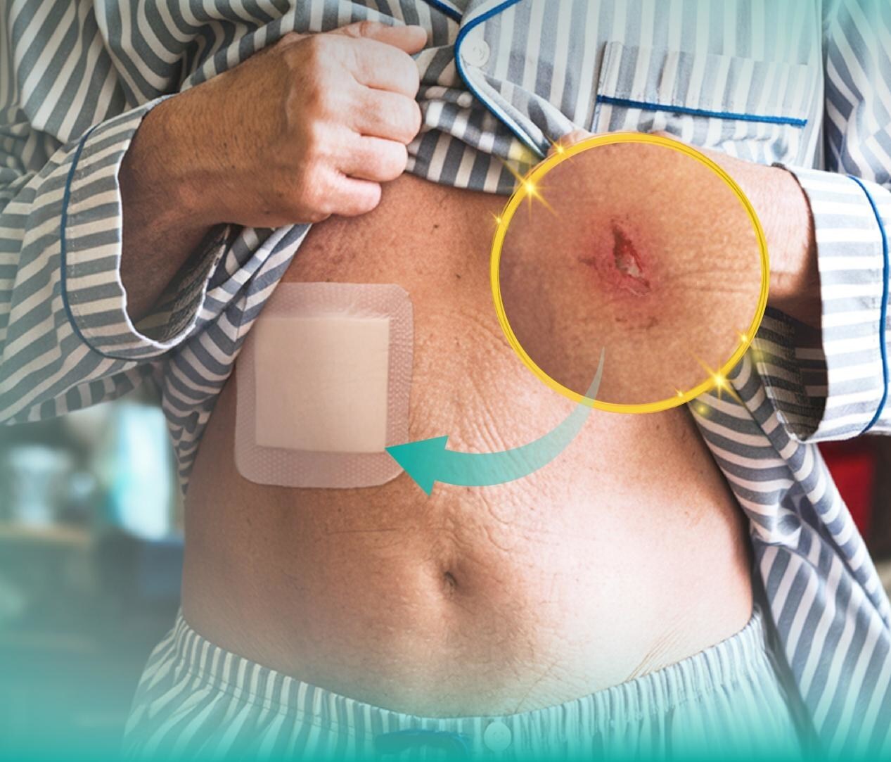 Wounds hard to heal? Troubled by dressing changes? Dimora, Amazon's 3 ...