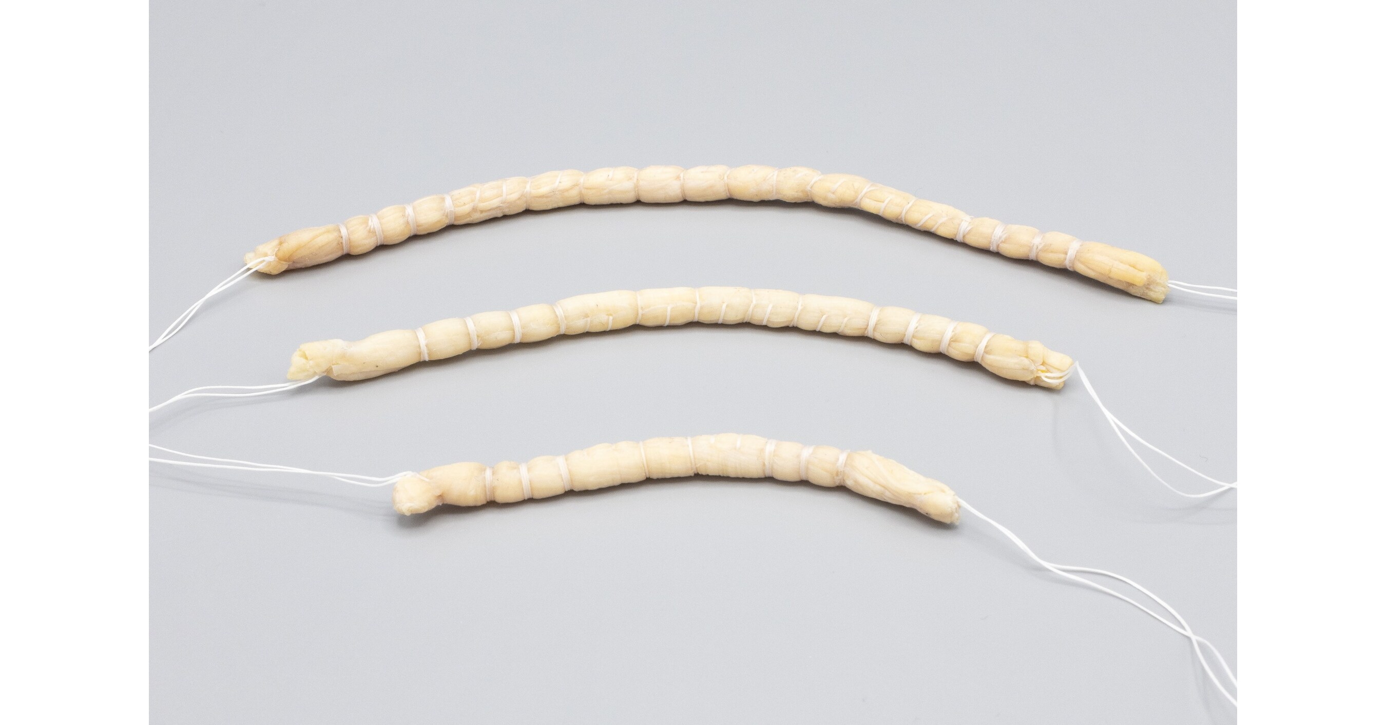ALLOSOURCE® ANNOUNCES 200TH IMPLANT OF ACECONNEX® PRE-SUTURED FASCIA ...