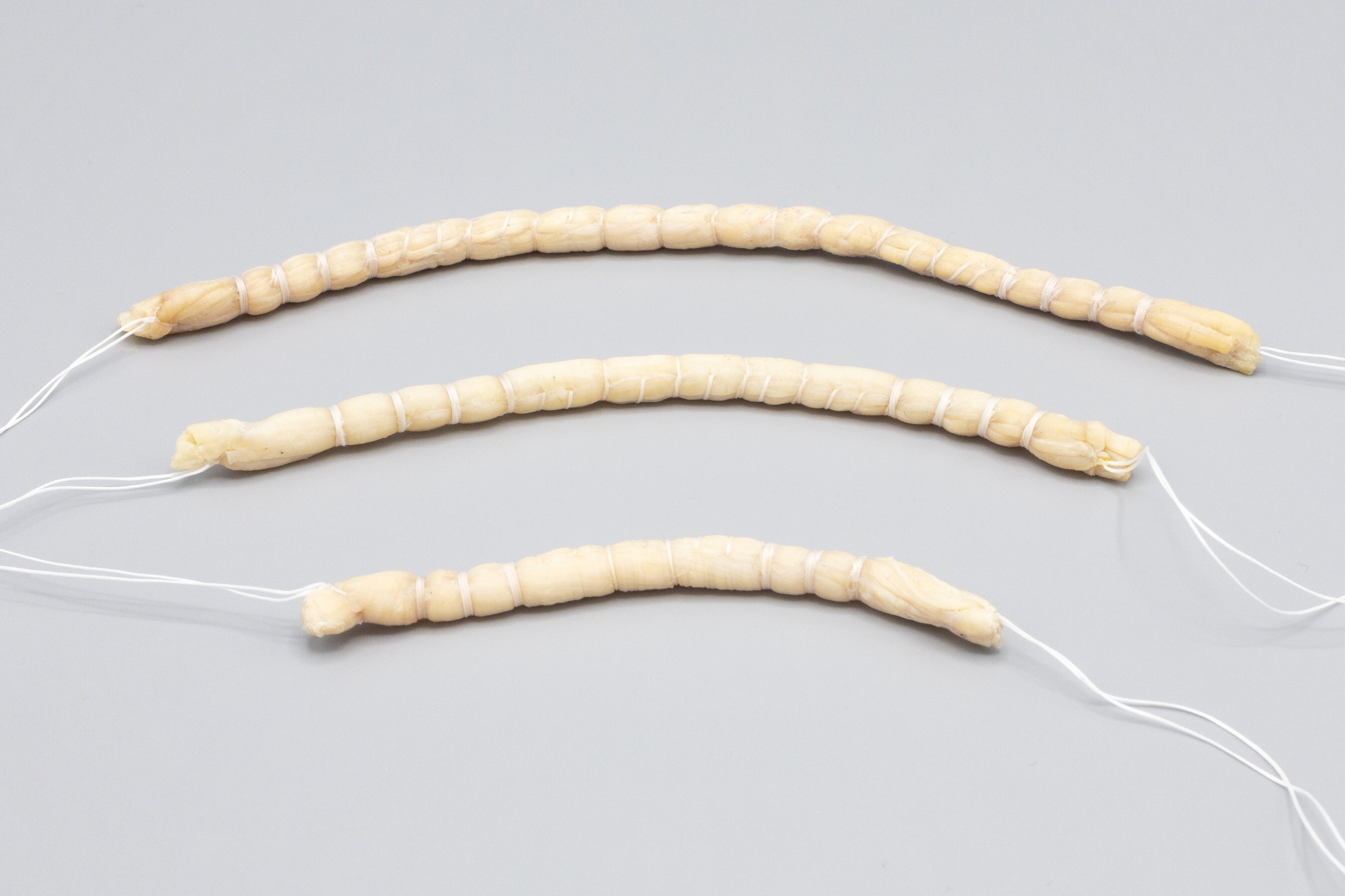 ALLOSOURCE® ANNOUNCES 200TH IMPLANT OF ACECONNEX® PRE-SUTURED FASCIA ...