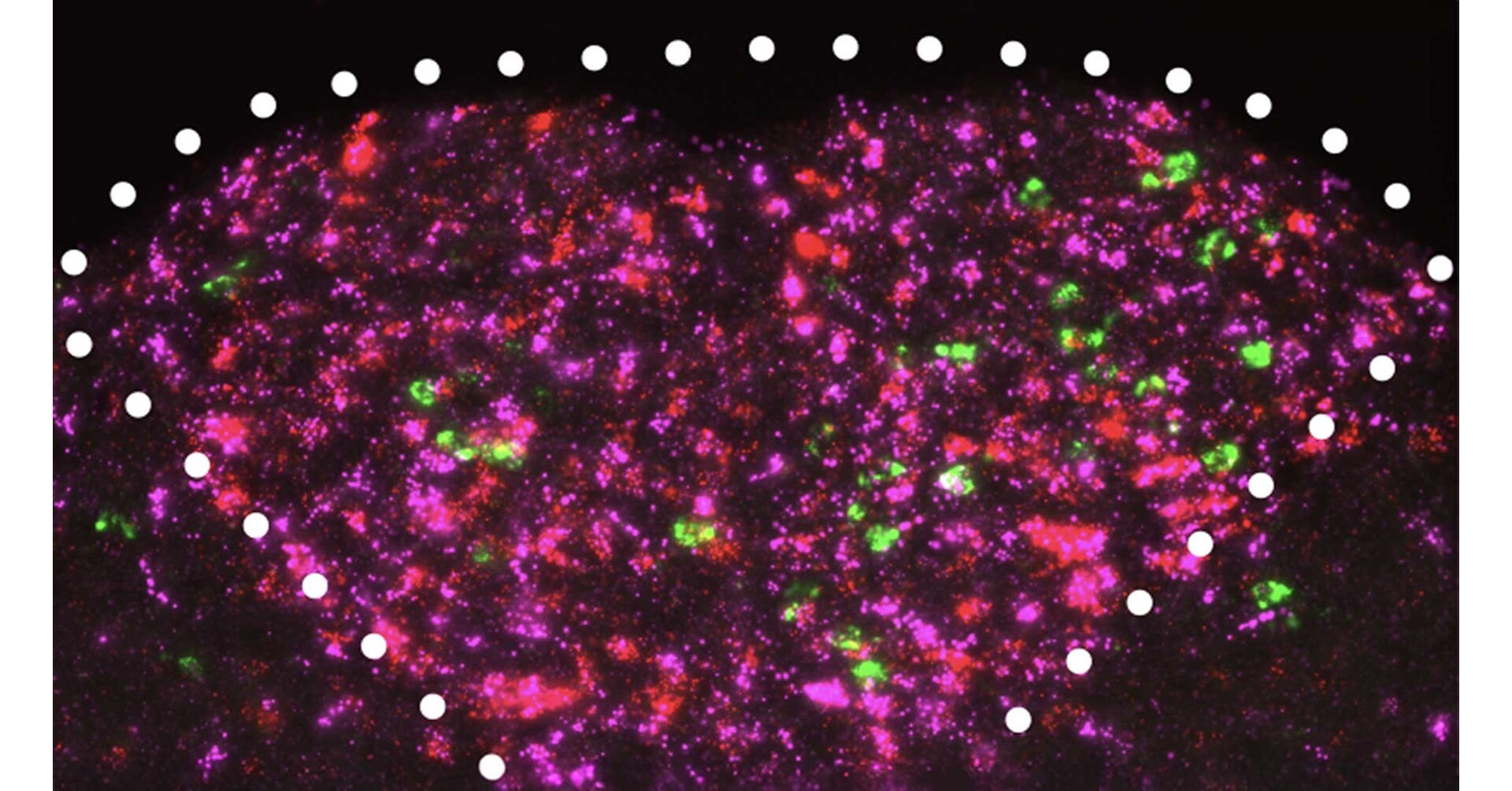 It's not you--it's cancer: CSHL Associate Professor Tobias Janowitz and ...