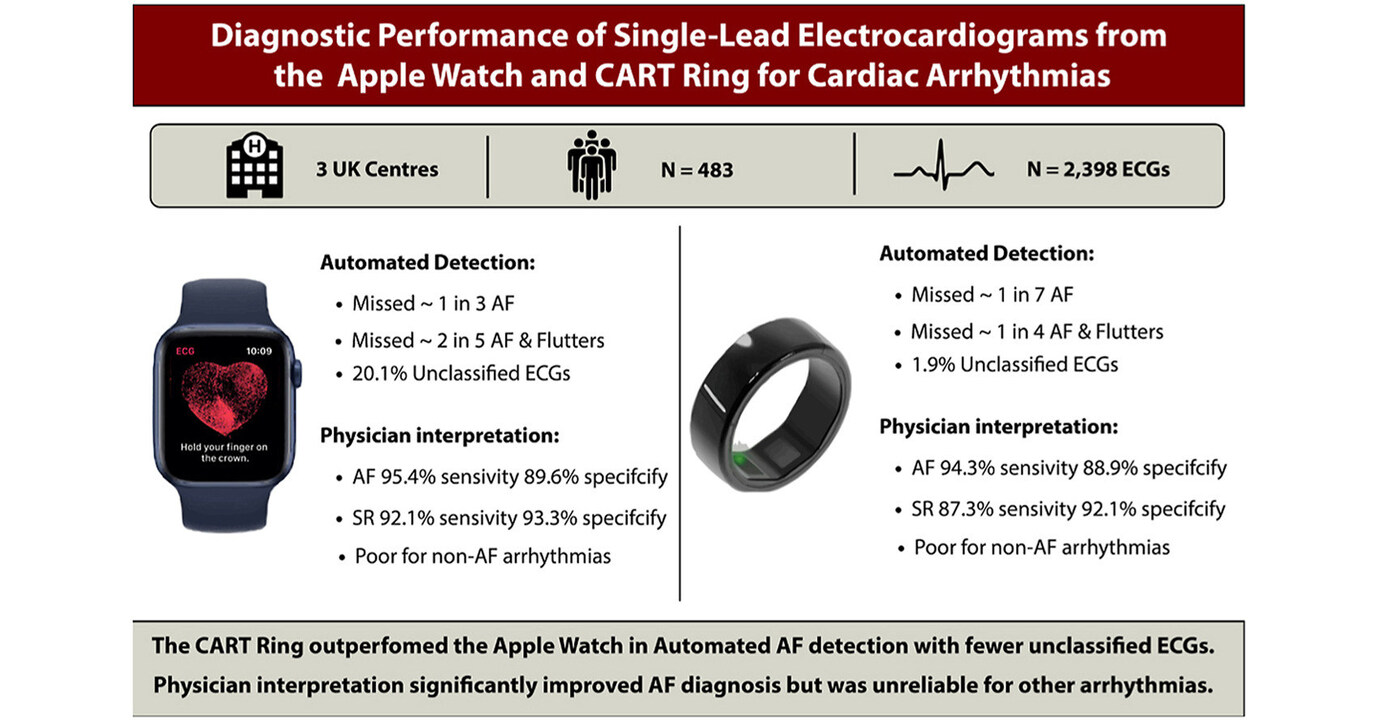 UK Clinical Study Finds Sky Labs' Smart Ring 'CART-I' More Sensitive ...