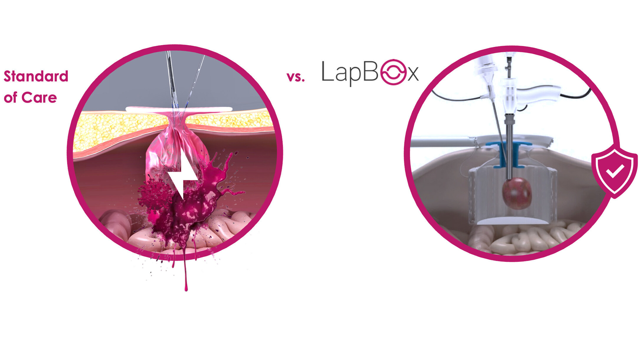 Ark Surgical Secures FDA Clearance for LapBox® POWER, First Dual-Wall ...