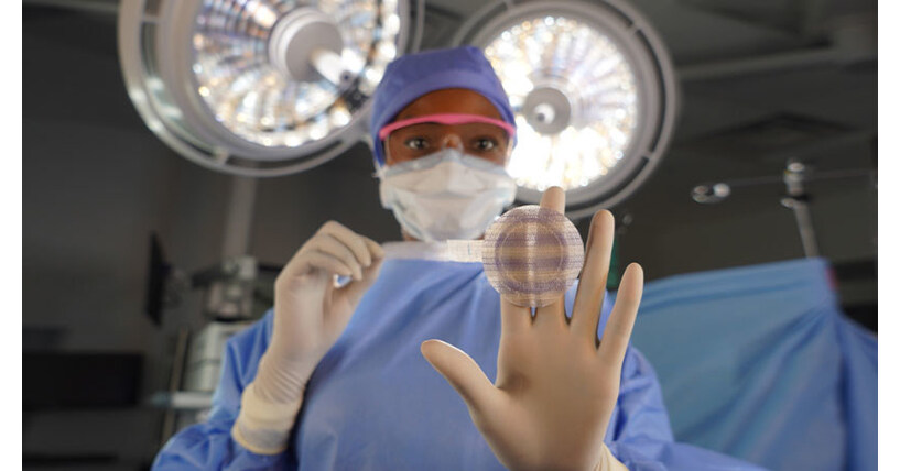 BD Launches Industry-First Bioabsorbable Mesh Designed for Umbilical ...