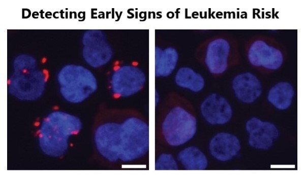 Bacteria in Our Aging Guts Can Elevate Risk of Leukemia