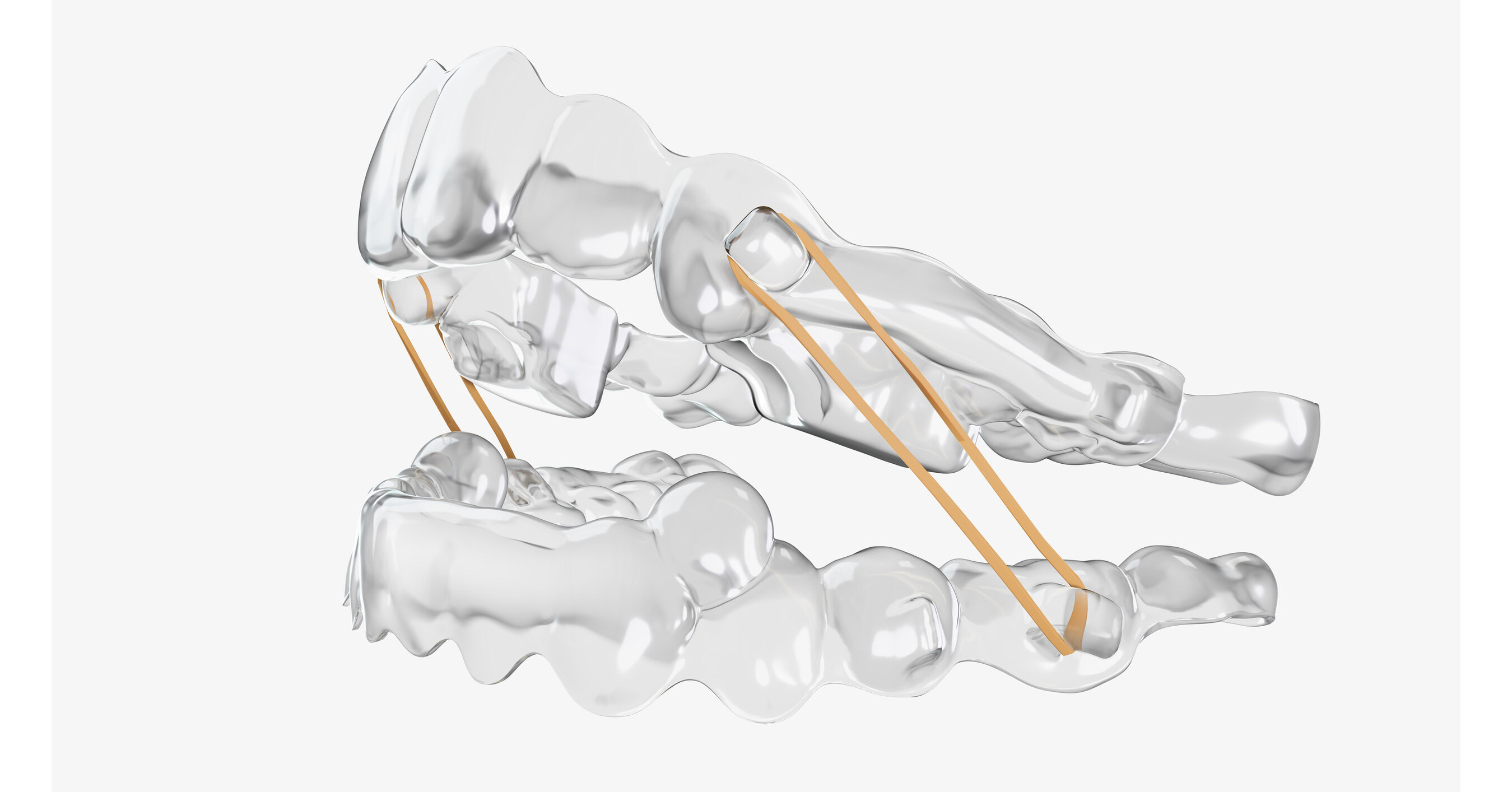 ORMCO™ ANNOUNCES THE LAUNCH OF SPARK™ RETAINERS & SPARK BITESYNC™ CLASS ...