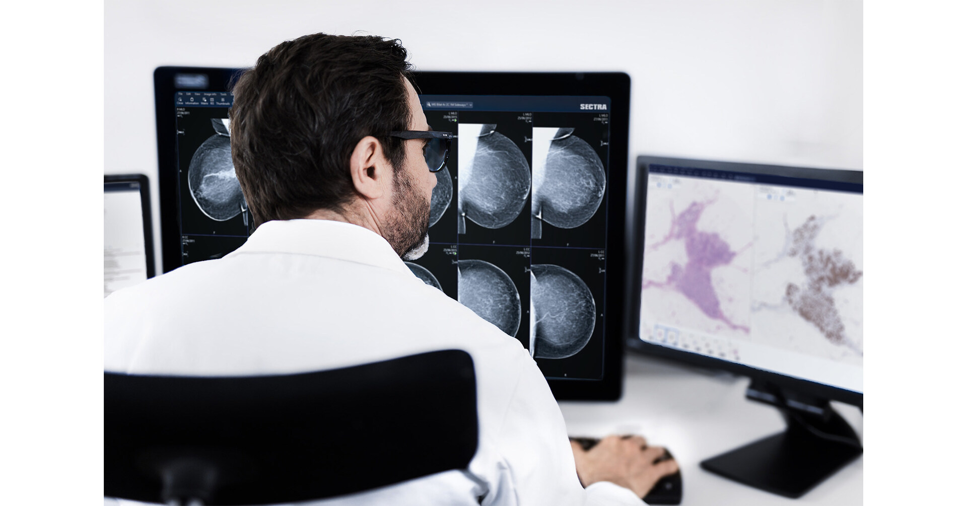 ONE OF THE WORLD'S MOST PRESTIGIOUS CANCER CENTERS ADOPTS SECTRA FOR INTEGRATED DIAGNOSTICS AND ...