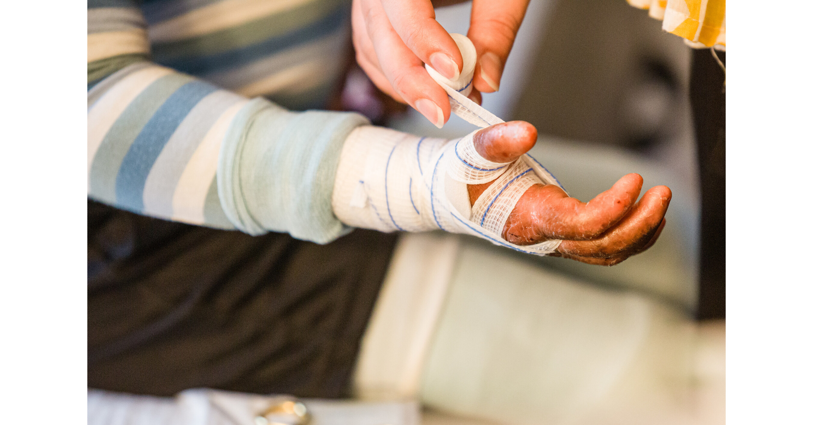 Historic achievement: FDA approval of Abeona Therapeutics' ZEVASKYN ...