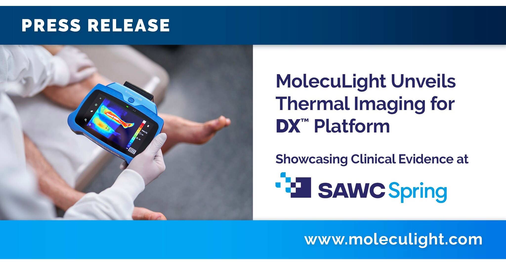 MolecuLight Unveils Thermal Imaging for DX™ Platform, Delivering Measurement, Bacterial ...