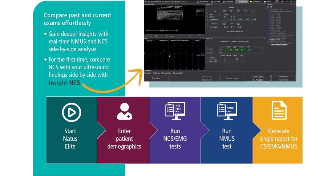 Natus announces integration of InVisus Pro NMUS into Natus Elite software
