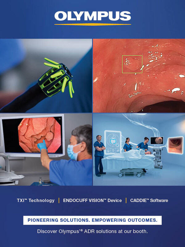 Olympus Demonstrates New AI Endoscopy Solution at DDW®