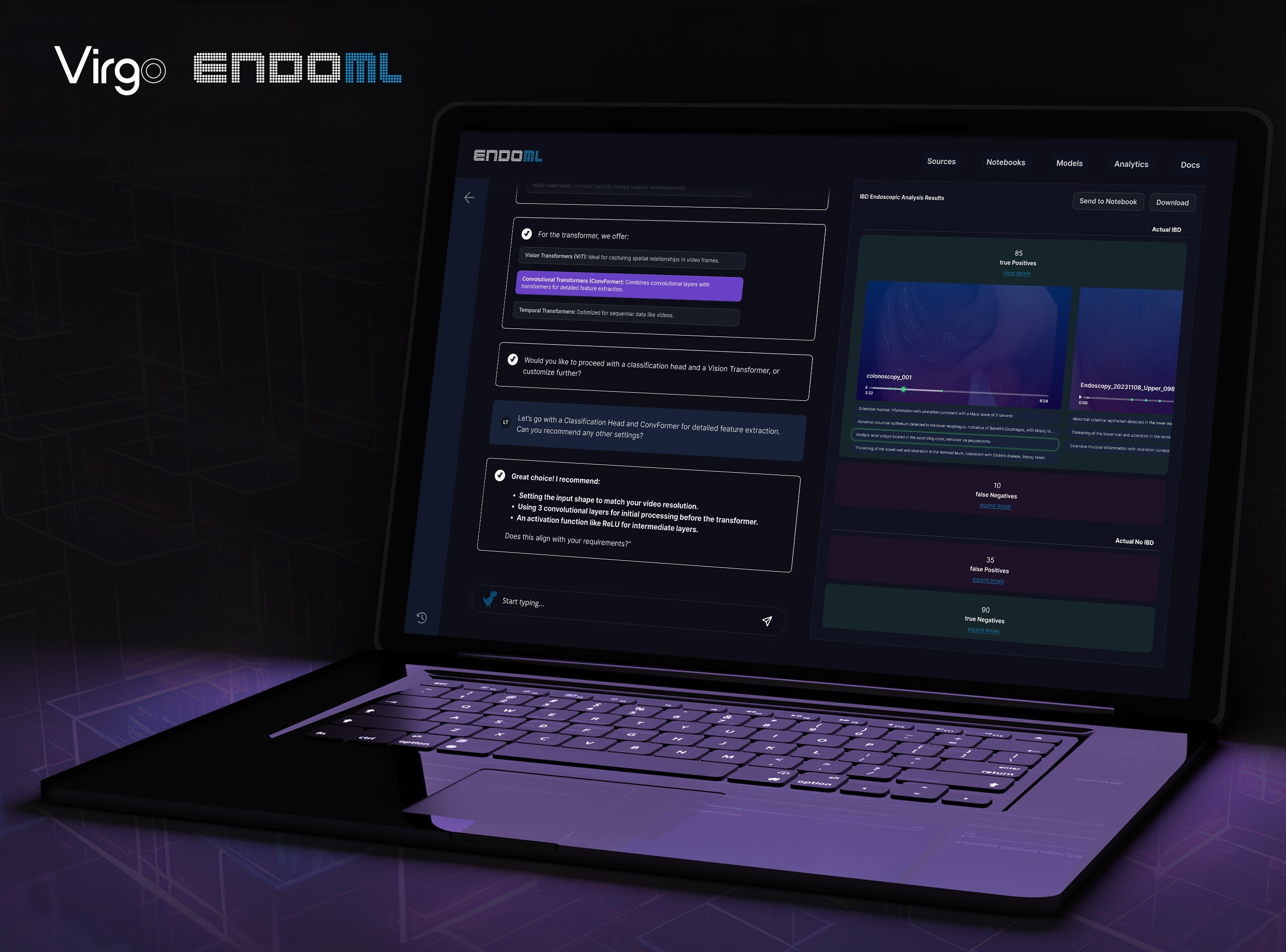 Virgo launches EndoML, a state-of-the-art AI development platform for gastroenterologists and ...