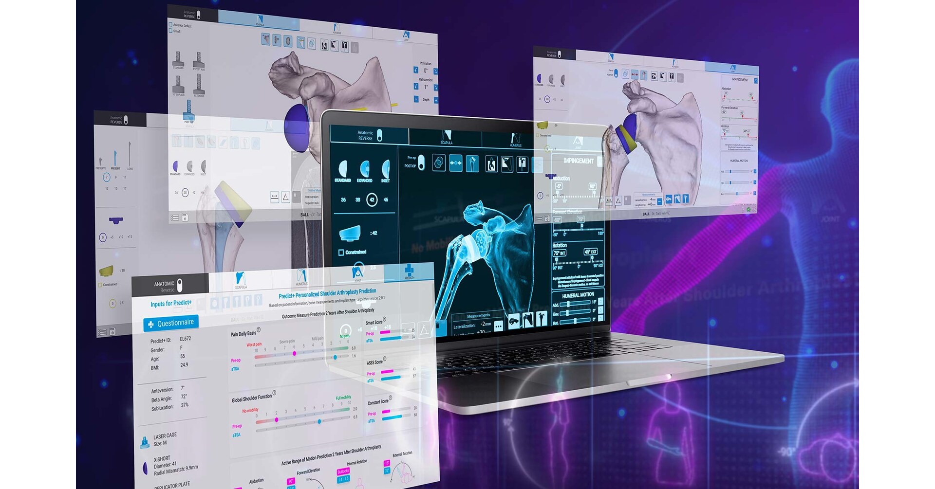 Exactech Launches Next-Generation Shoulder Planning App with Advanced ...