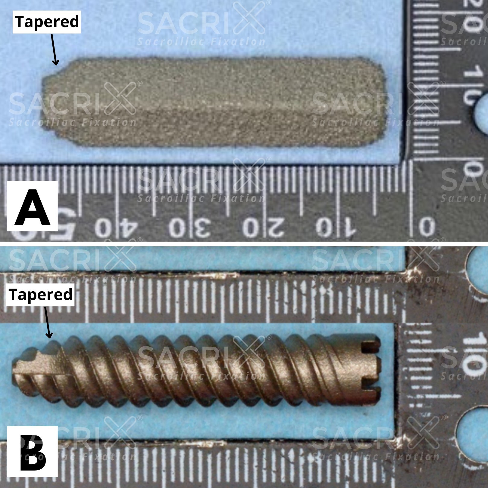 New Study Confirms Sacrix® Fully Threaded Screw Outperforms SI-Bone’s ...