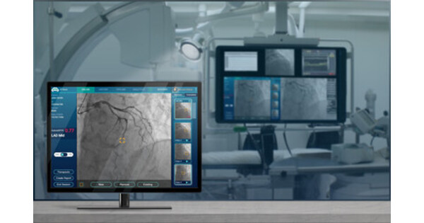 MedHub-AI Receives PMDA Approval in Japan for AutocathFFR®