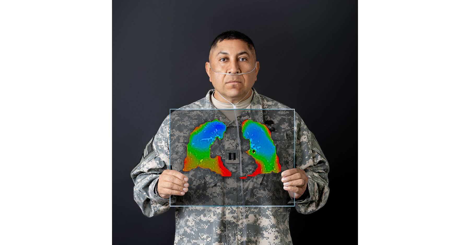 Lung Scan Technology Reveals Hidden Secrets of Airway Disease
