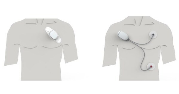 InfoBionic.Ai Announces FDA Clearance of its MoMe ARC® Patch, Ushering ...