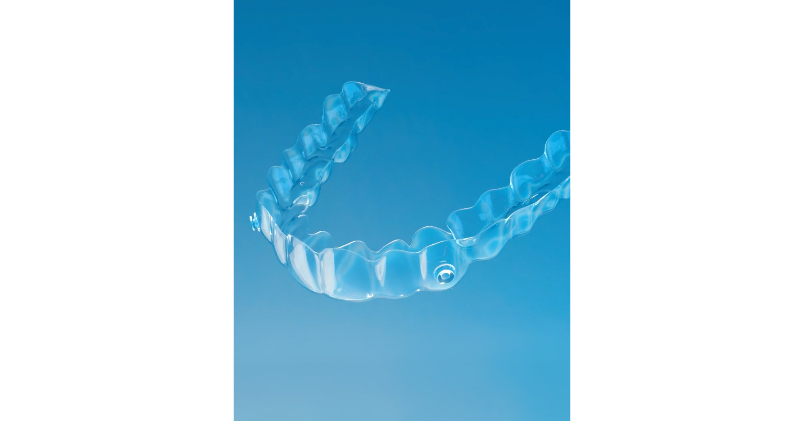 Angelalign Technology nega violação de patente e promete defesa vigorosa