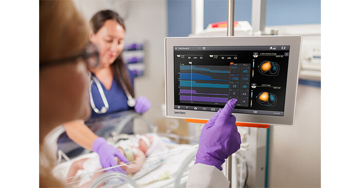 Sentec Receives FDA Clearance for LuMon™ Electrical Impedance ...