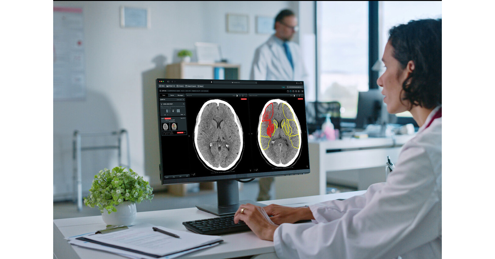 Brainomix Stroke AI Software Hailed as ῾Revolutionary,' Helping More ...