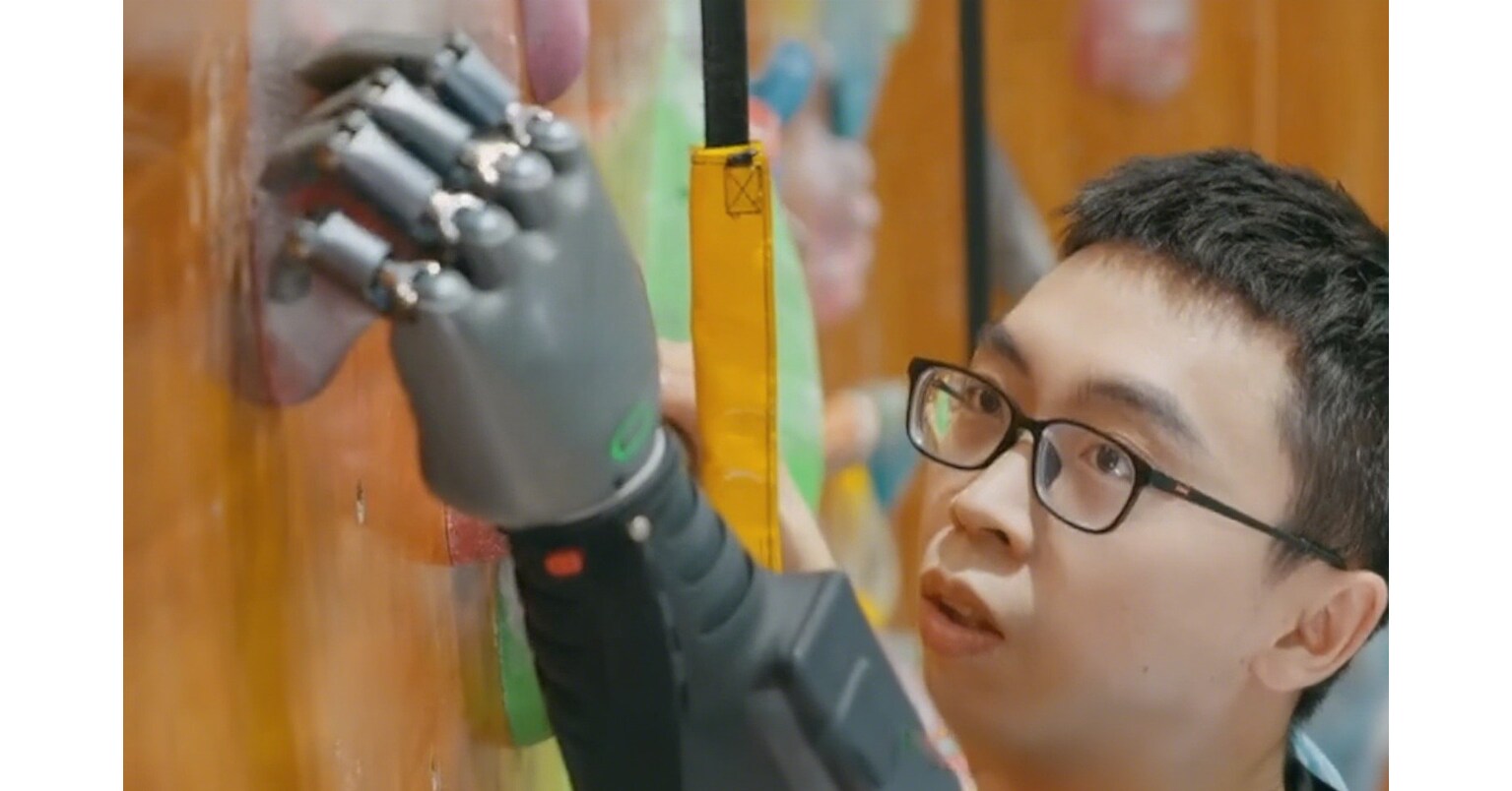 BrainCo Helps Amputee Showcase Technology at WAIC 2025