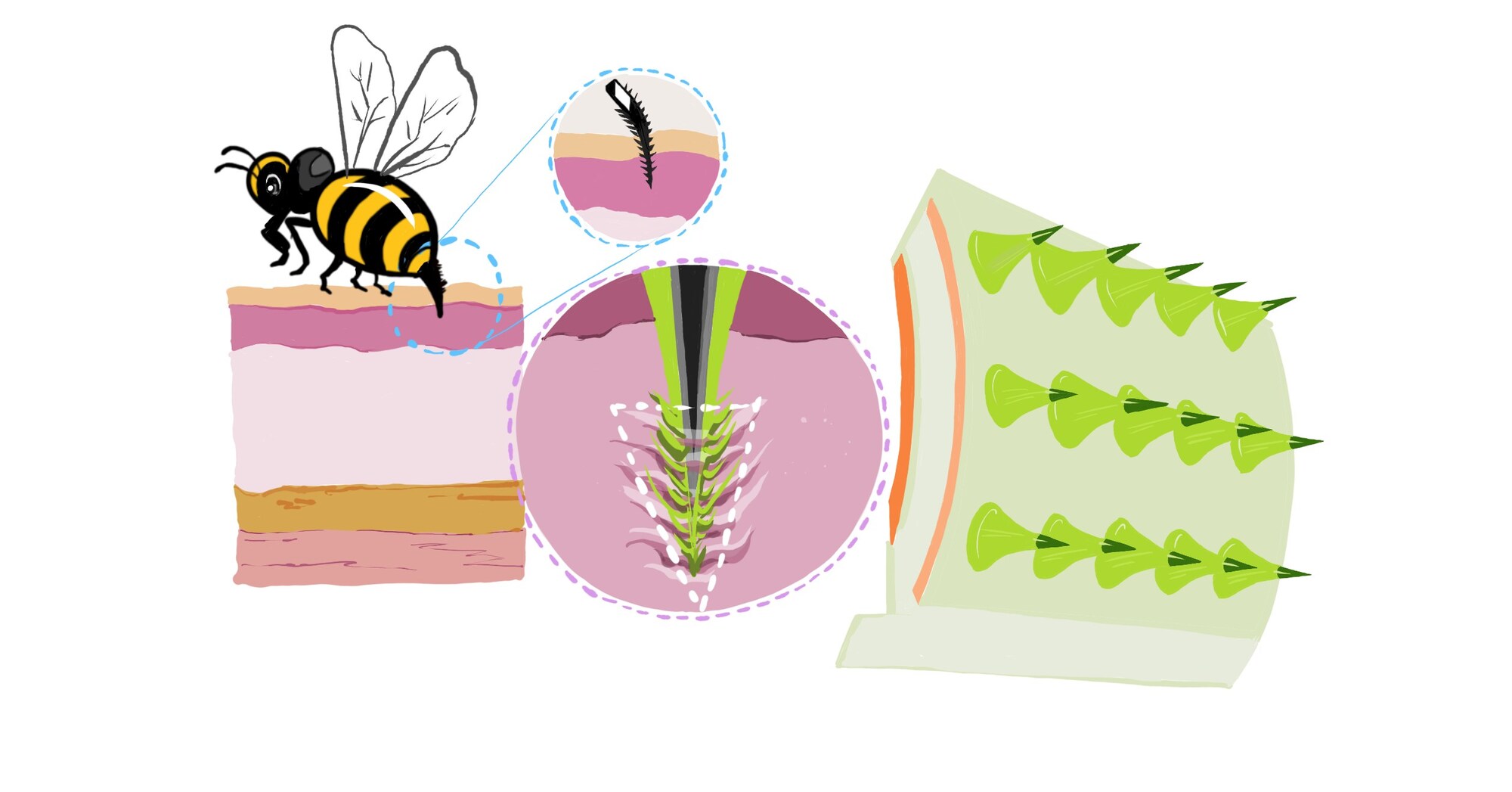 Bee-Sting Inspired Microneedles from Chung-Ang University Could ...