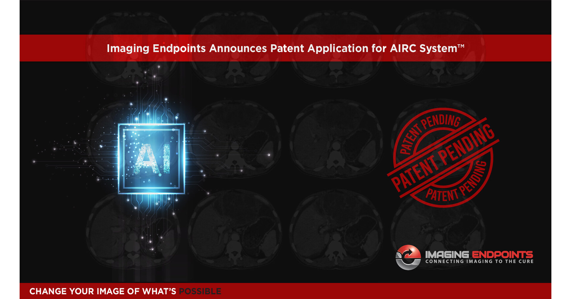 Imaging Endpoints Announces Patent Application for AI Review Charter System